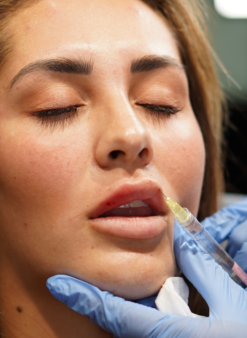 Injectables | The Aesthetics Lounge and Spa Raleigh