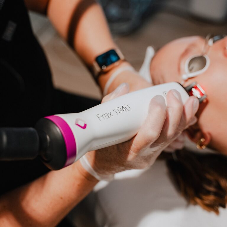 Revitalize Your Skin with Frax 1940 Laser at The Aesthetics Lounge and ...